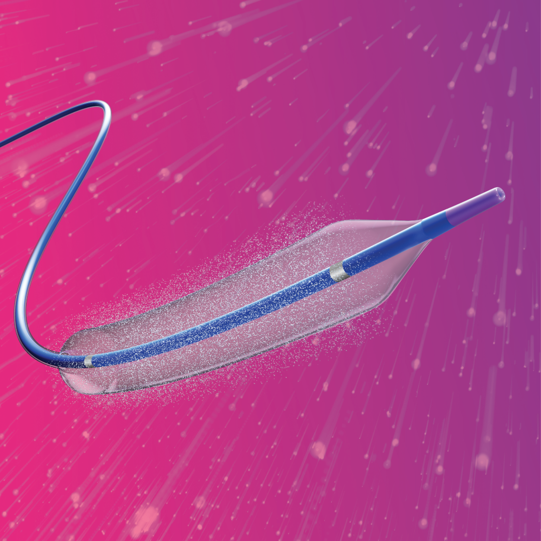 iVascular Essential Pro DCB Studied in Treatment of Coronary ISR - Cardiac Interventions Today